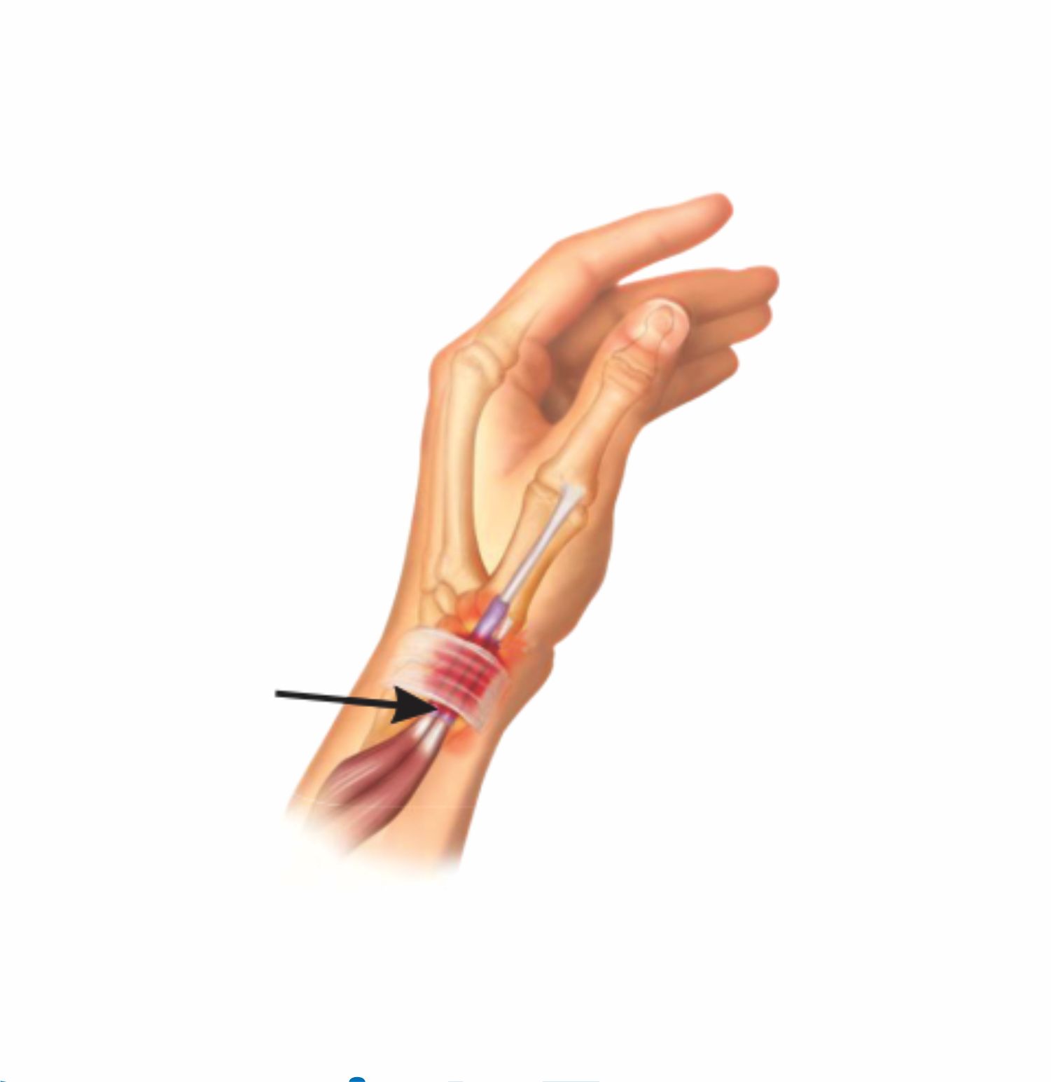 Pharmed | Doctor’s Corner